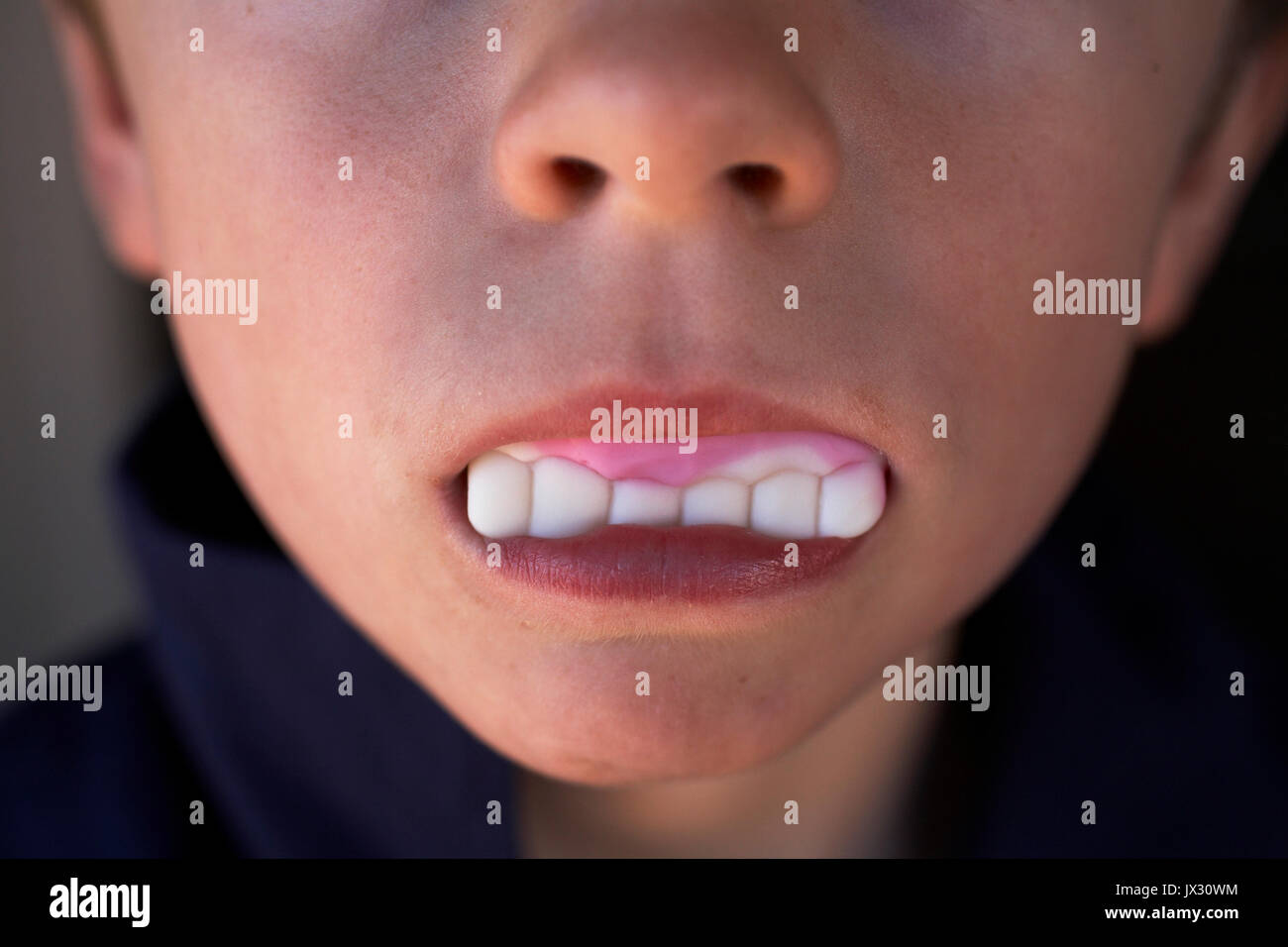 boy 8 with fake sweet candy teeth Stock Photo - Alamy