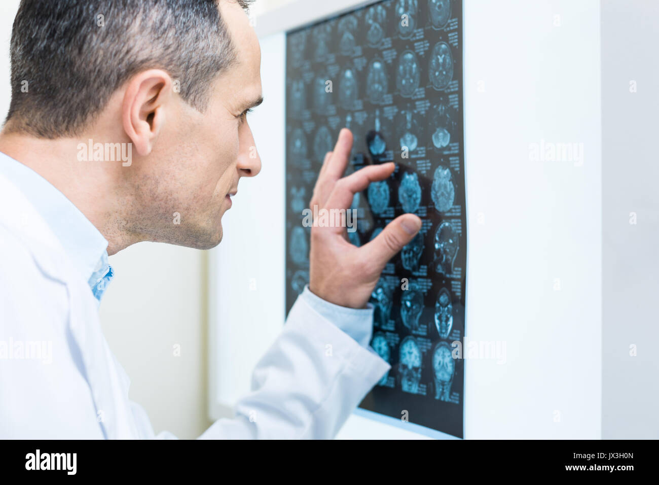 Close up of doctor analyzing results of computer tomography Stock Photo ...