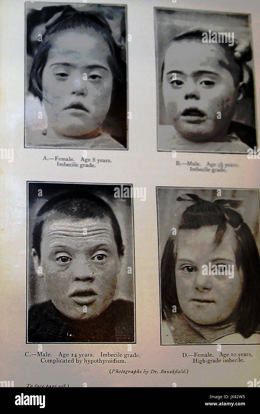 'MENTAL DEFICIENCY' (Amentia), FIFTH EDITION, 1929 IMG 3569 edited 18 ...