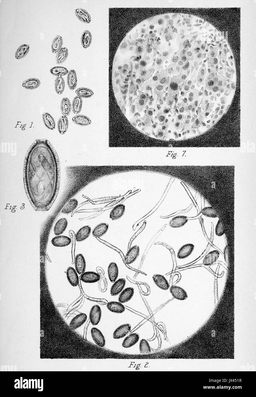 Trichocephalus hepaticus Bancroft 1893 Plate VII Stock Photo - Alamy