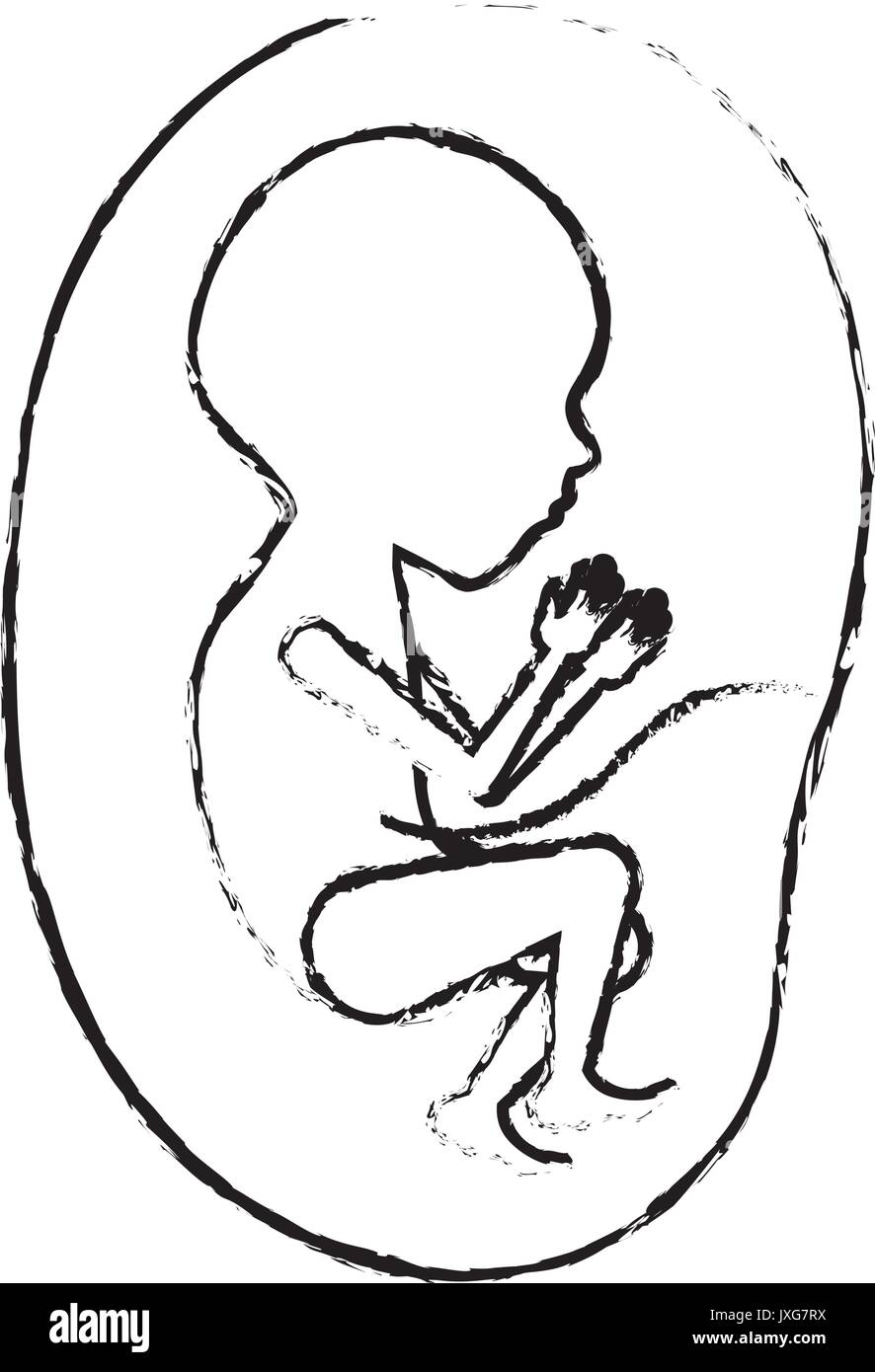 Human embryo ultrasound Black and White Stock Photos & Images - Alamy