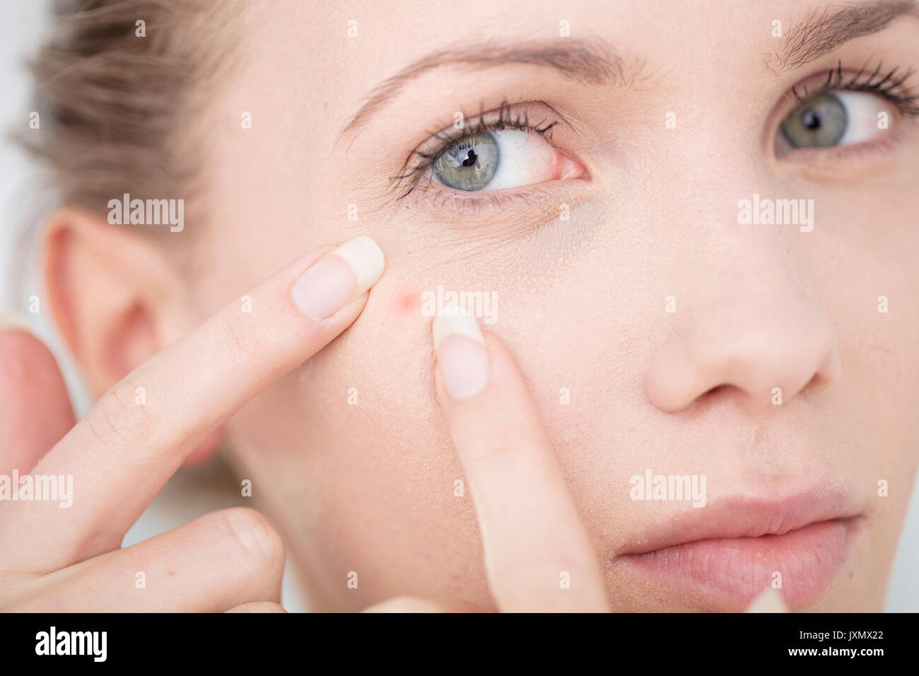 Young woman about to squeeze spot Stock Photo - Alamy