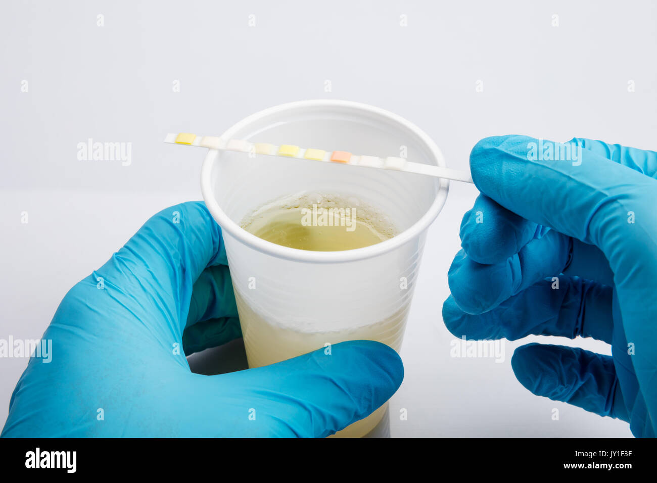 Close-up Of Medical Urine Test Examined By Doctor In Clinic Stock Photo ...