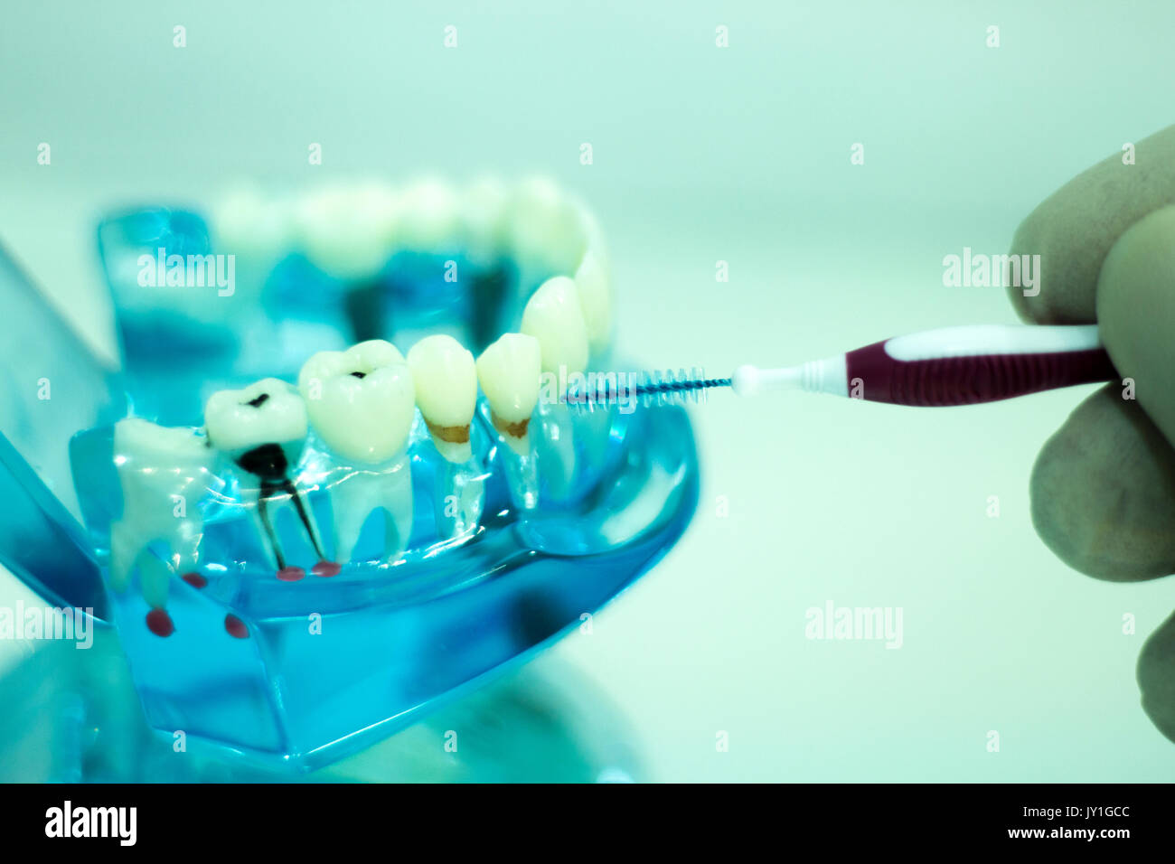 Dental teeth orthodontic dentistry teachng model with gums, tooth ...