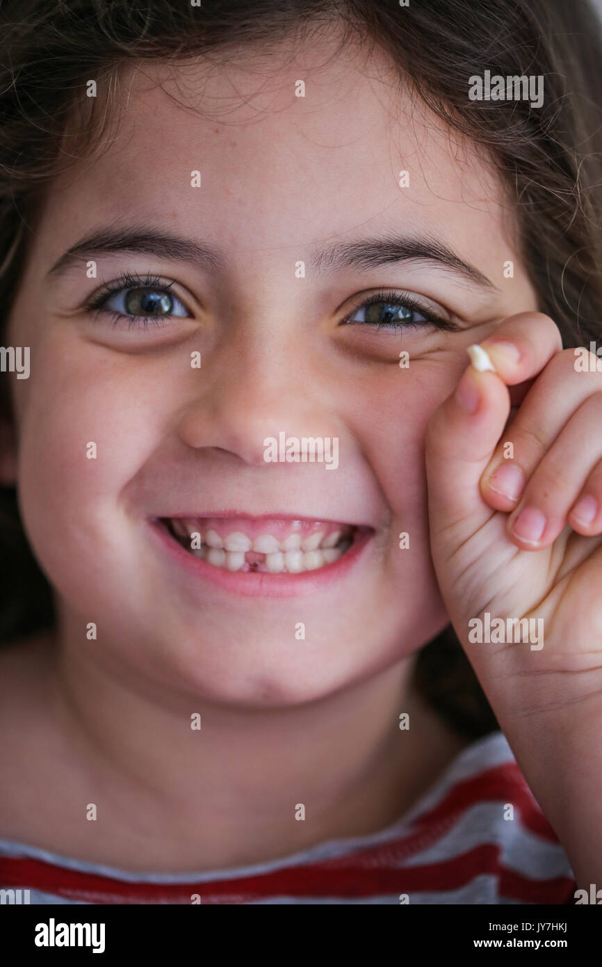Loose tooth hi-res stock photography and images - Alamy