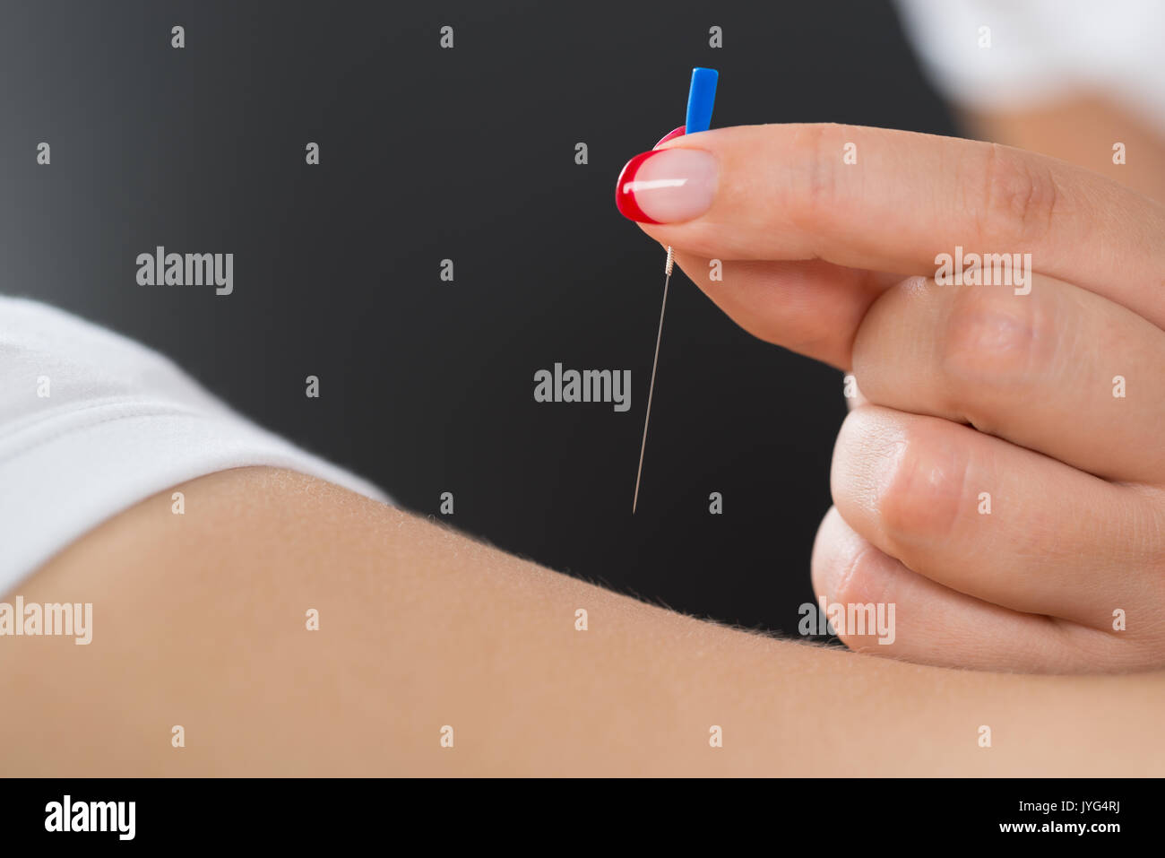 Close-up Of Therapist Hands Putting Acupuncture Needle On Woman's Back ...
