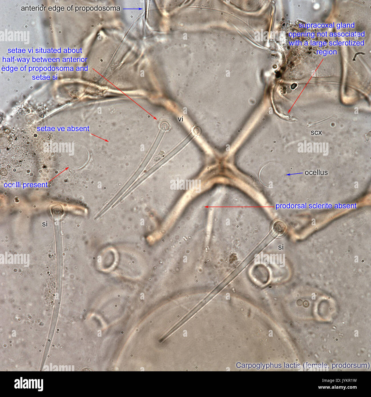 8 Carpoglyphus lactis Vladivostok female2 prodorsum BF100 Stock Photo ...