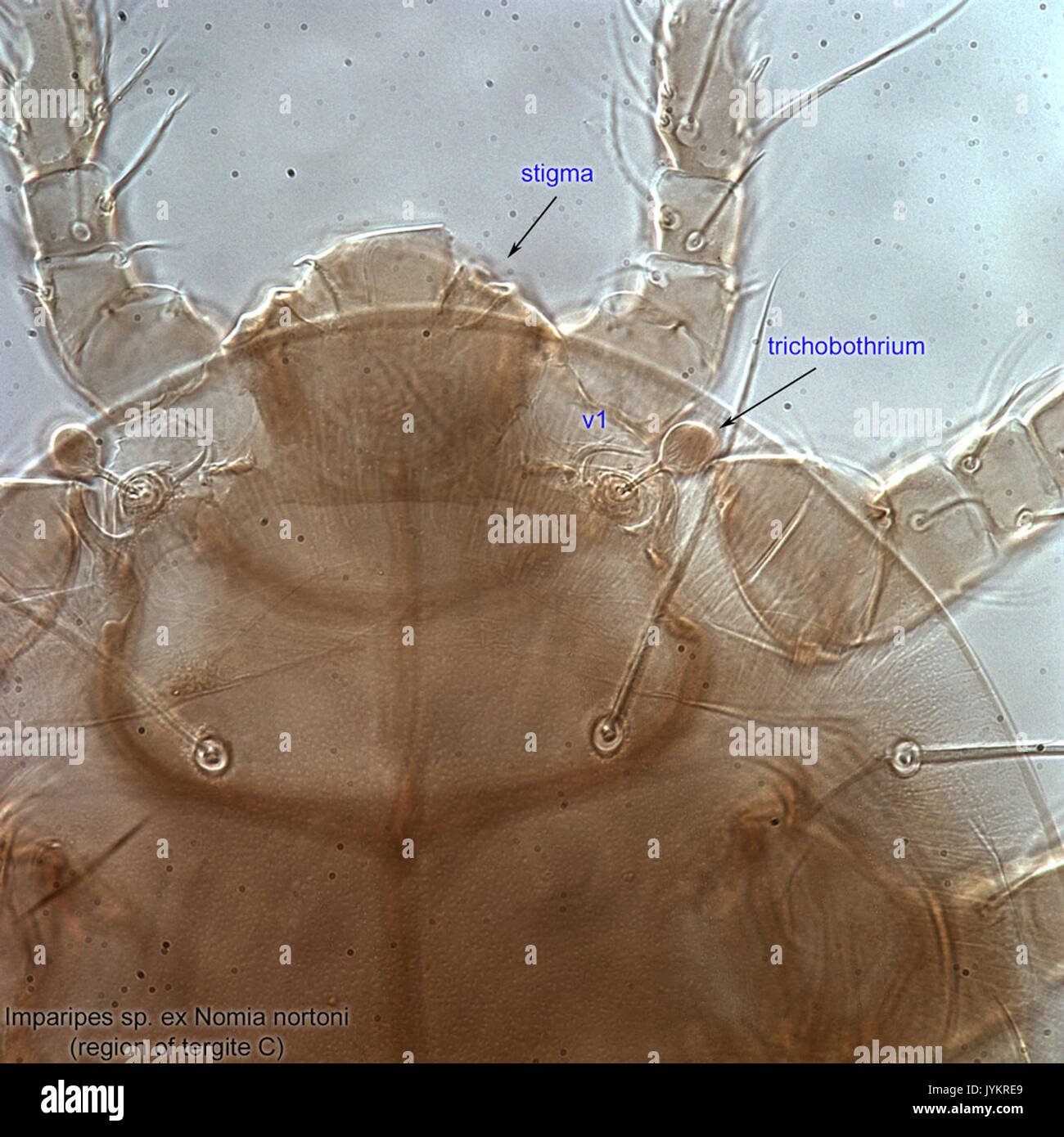 4 Imparipes female3 trichobothria DIC100 BMOC 96 0916 062 Stock Photo ...