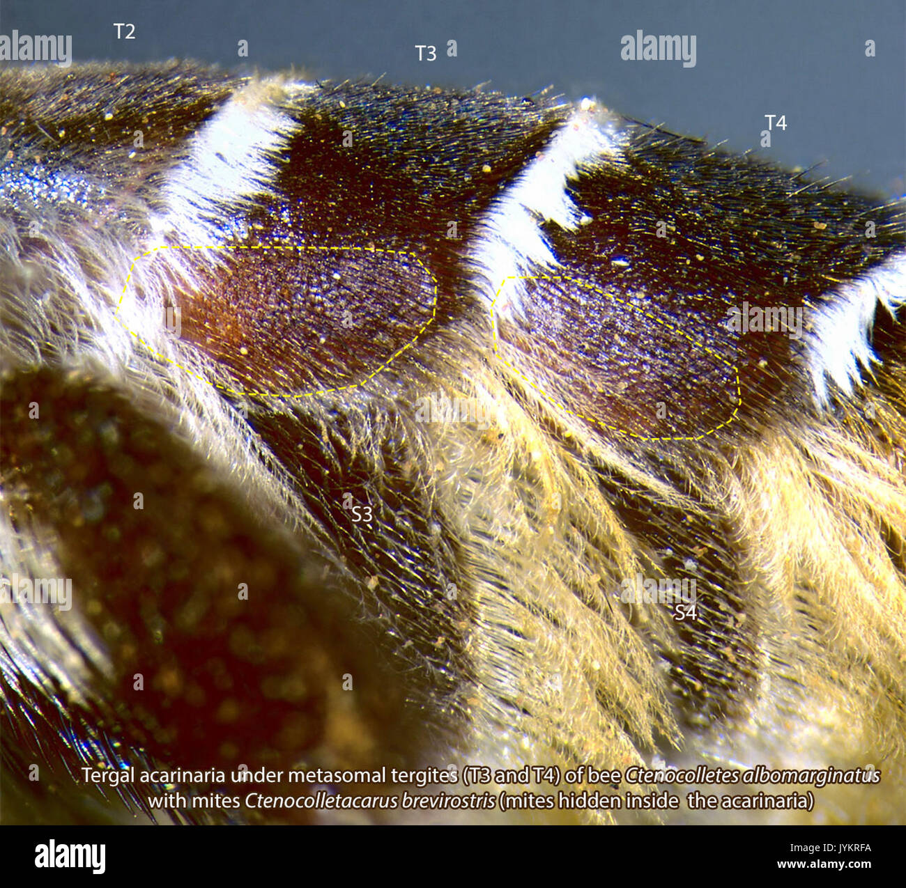 4 Sancassania Ctenocolletes albomarginatus tergal acarinarim with ...