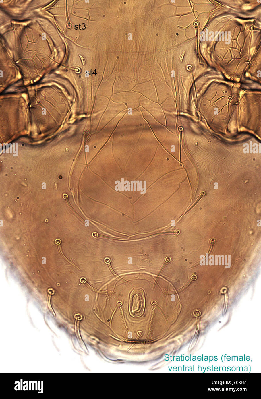 Hysterosoma hi-res stock photography and images - Alamy