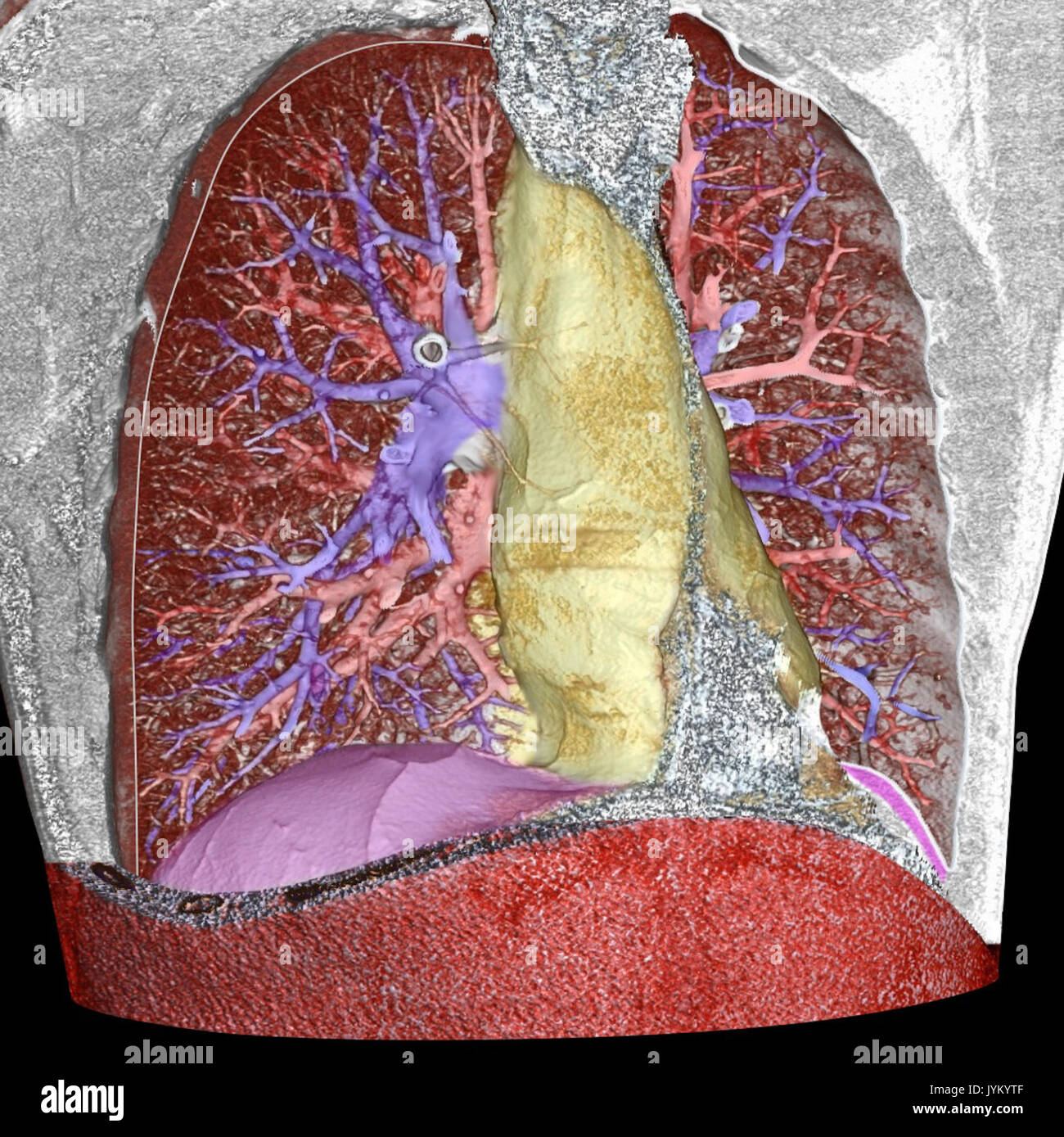 3D CT of thorax Stock Photo - Alamy