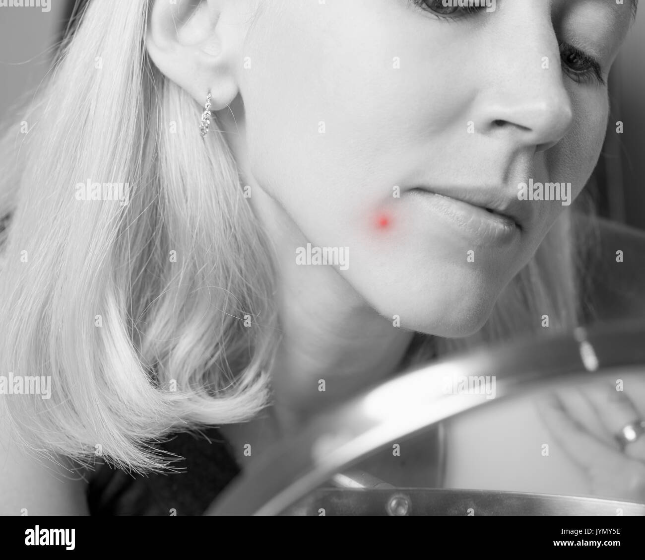 Teenage girl pimples hi-res stock photography and images - Alamy