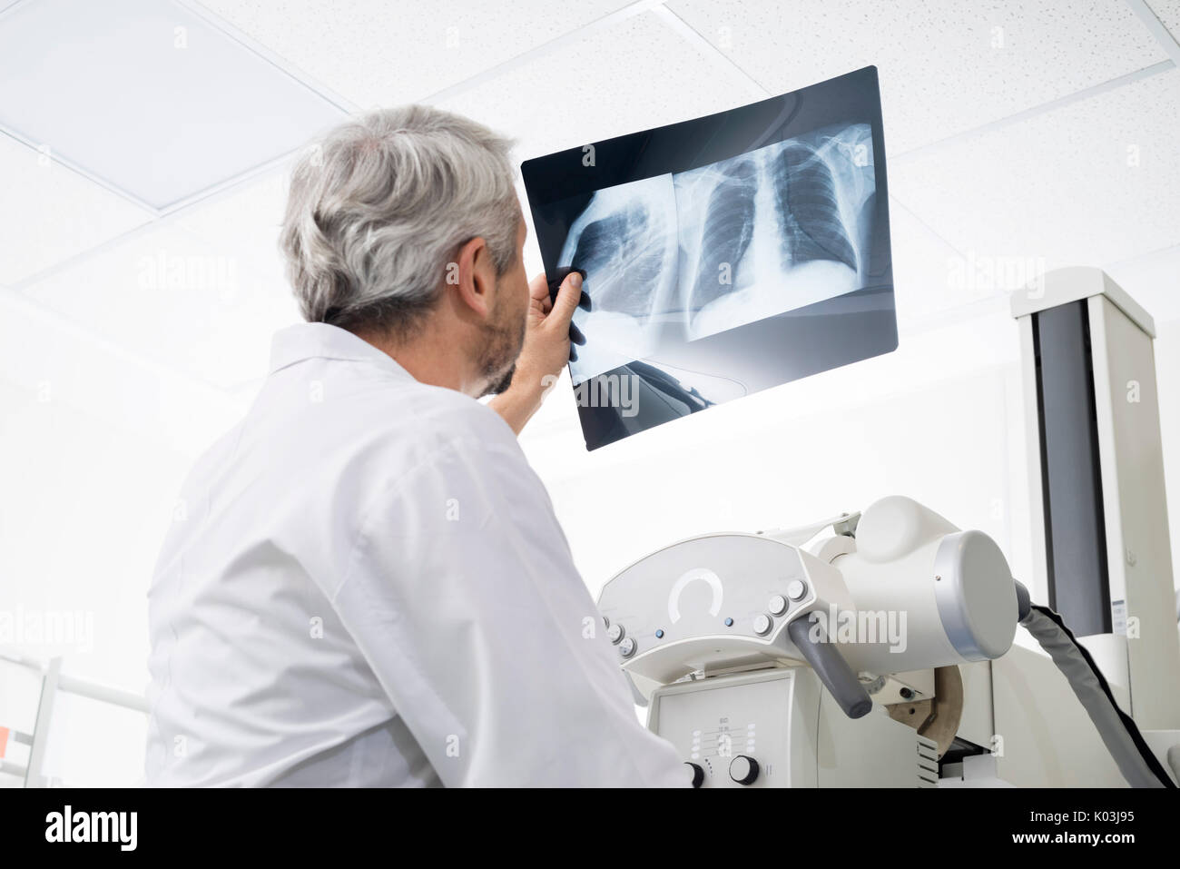 Chest x ray hi-res stock photography and images - Alamy