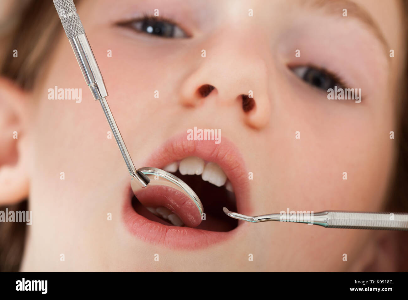 Open mouth teeth fillings hi-res stock photography and images - Alamy