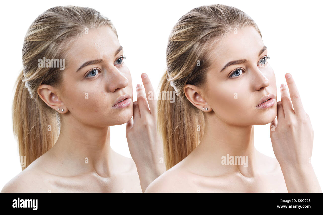 Before after comparison model hi-res stock photography and images - Alamy