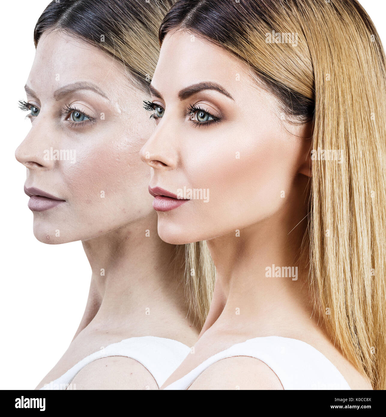 Woman with problem skin Stock Photo - Alamy