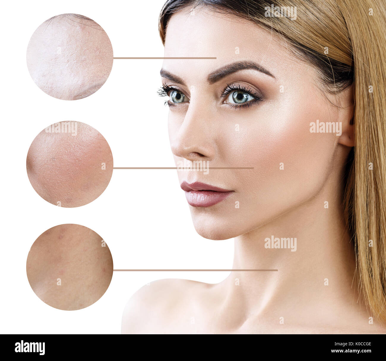 Circles shows problem skin of adult woman Stock Photo - Alamy
