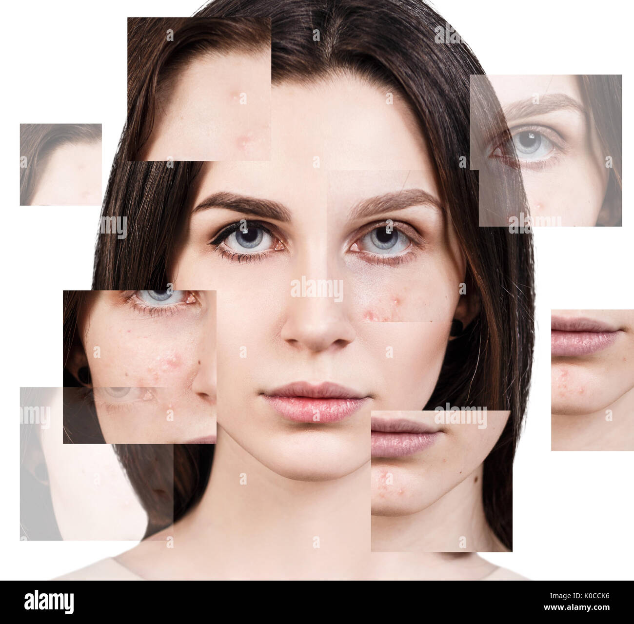 Square parts shows before skin problems Stock Photo - Alamy