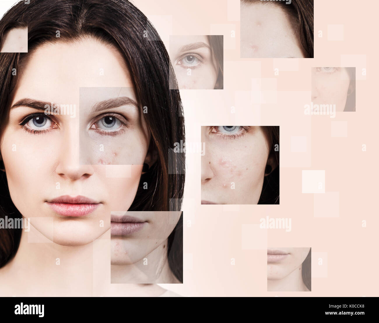 Square parts shows before skin problems Stock Photo - Alamy
