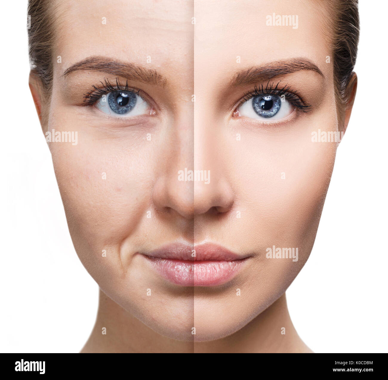 Woman's face before and after rejuvenation Stock Photo - Alamy