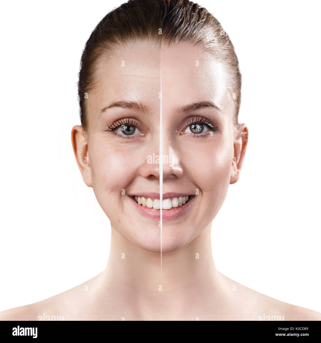 Woman's face before and after rejuvenation Stock Photo - Alamy