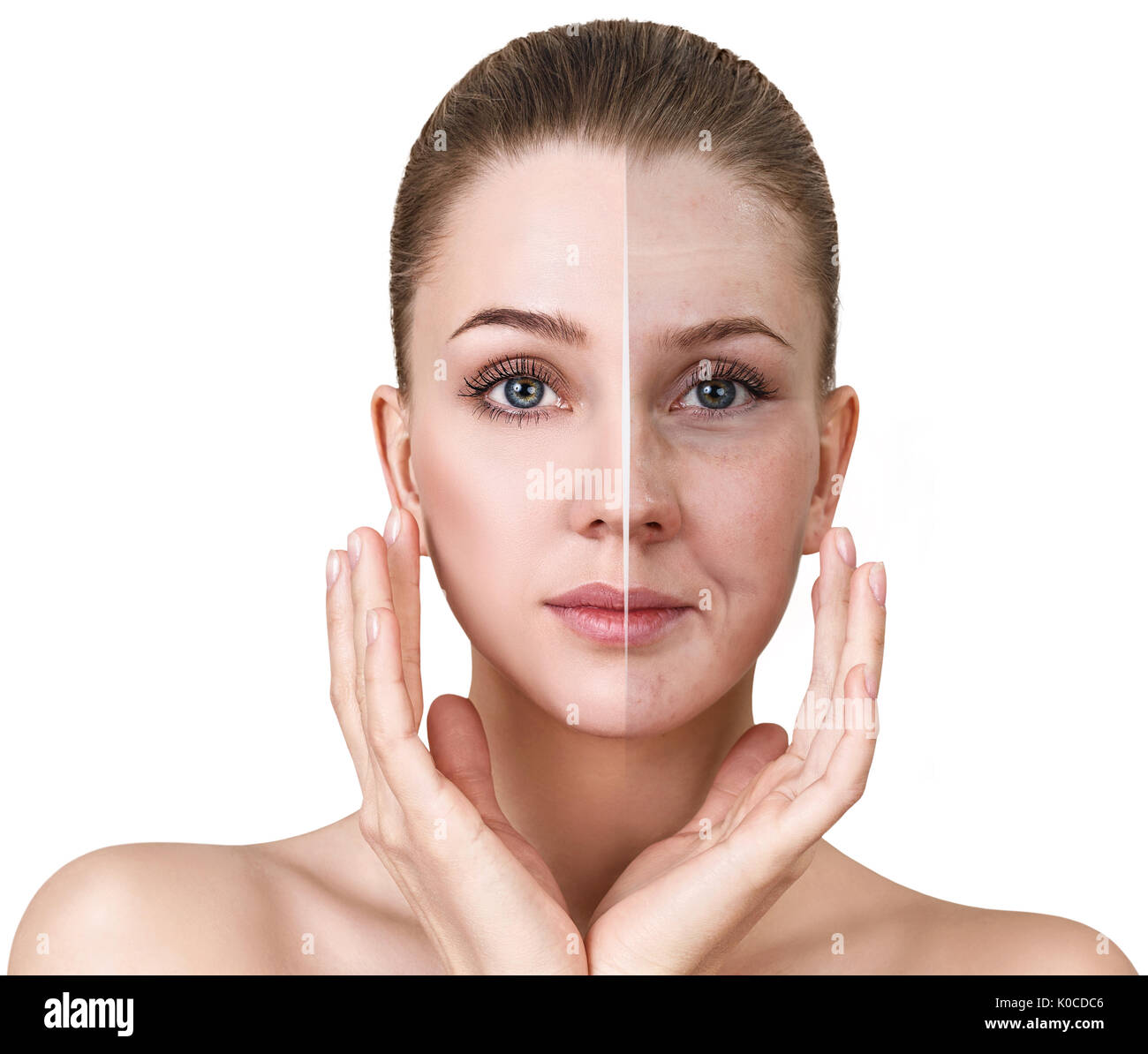 Woman's face before and after rejuvenation Stock Photo - Alamy