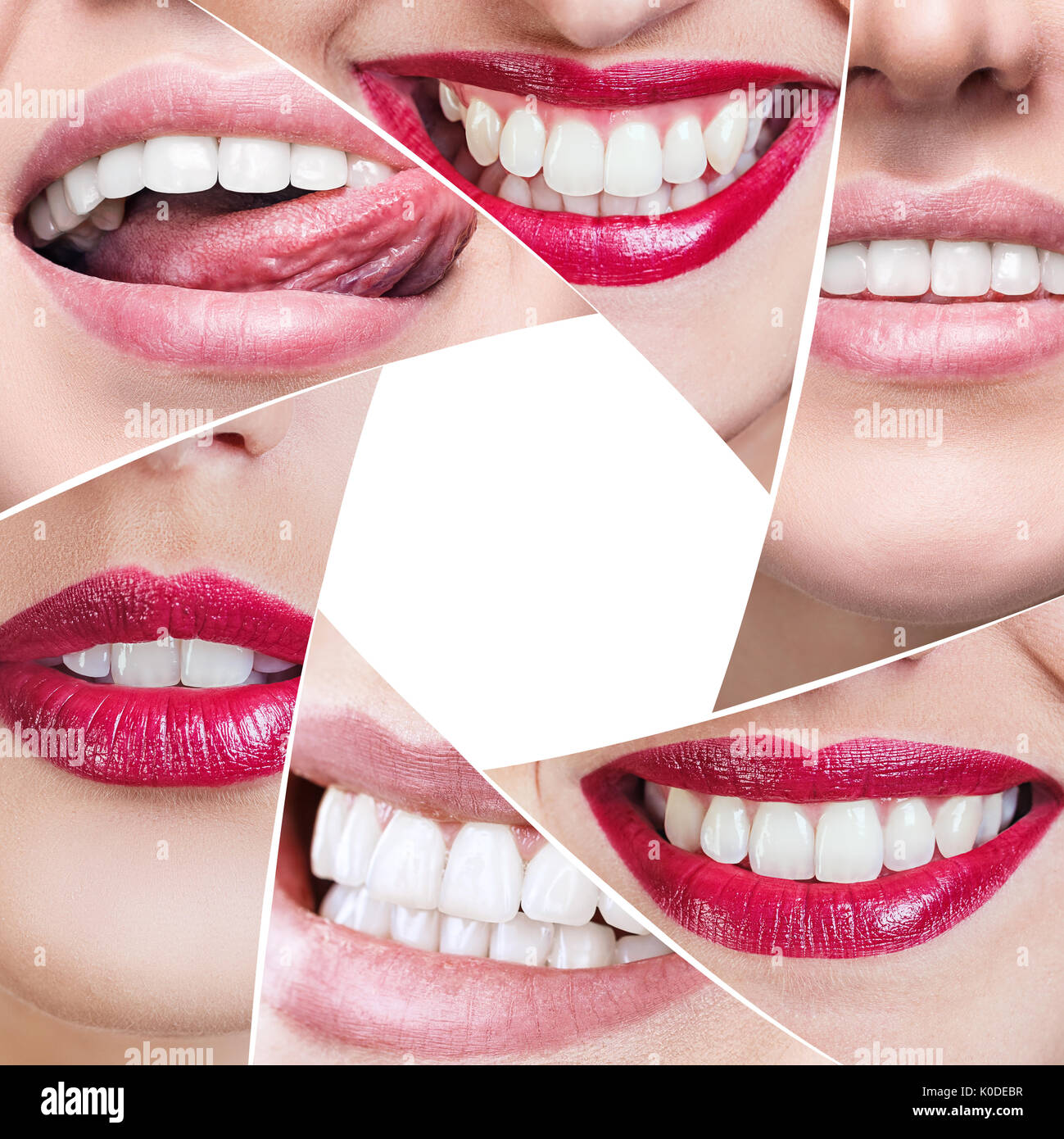 Teeth shape hi-res stock photography and images - Alamy