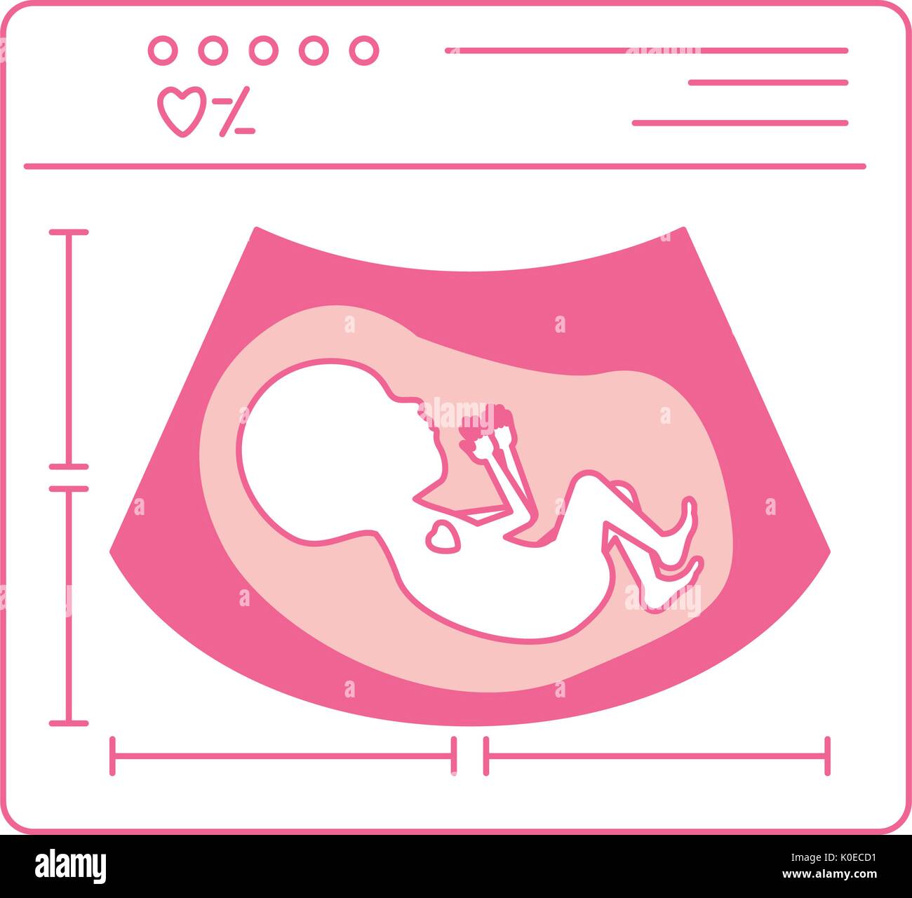 Medical ultrasound examination fetus Stock Vector Images - Alamy