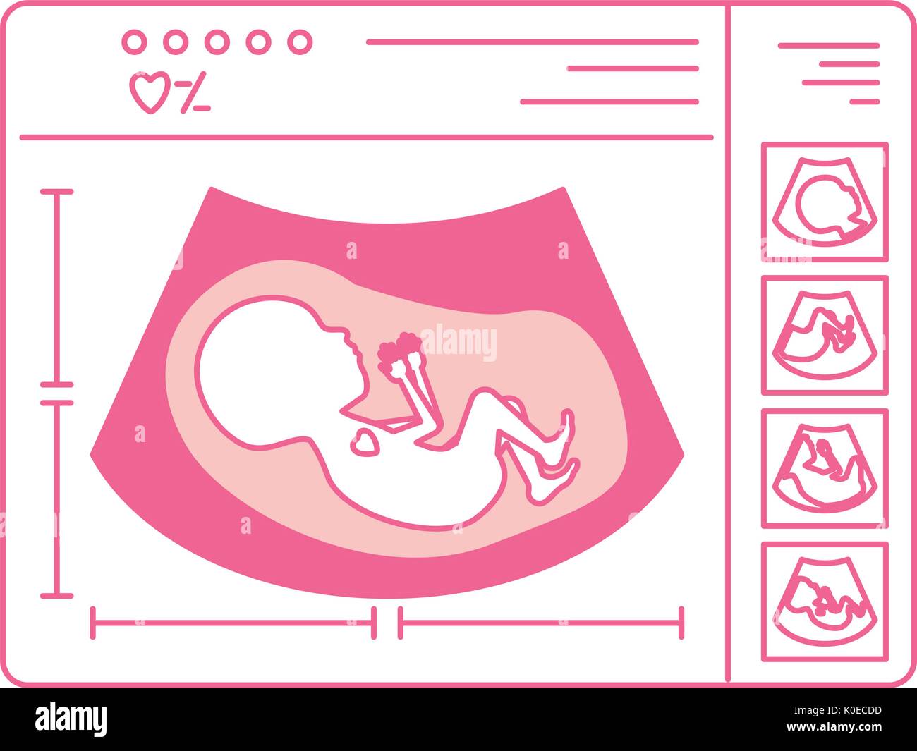 pink silhouette of monitoring ultrasound of baby in device Stock Vector ...