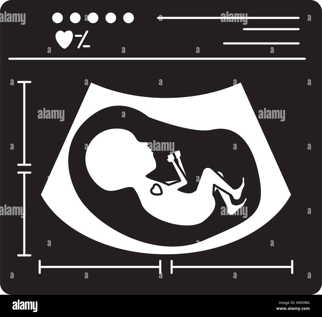 Ultrasound fetus and newborn Stock Vector Images - Alamy