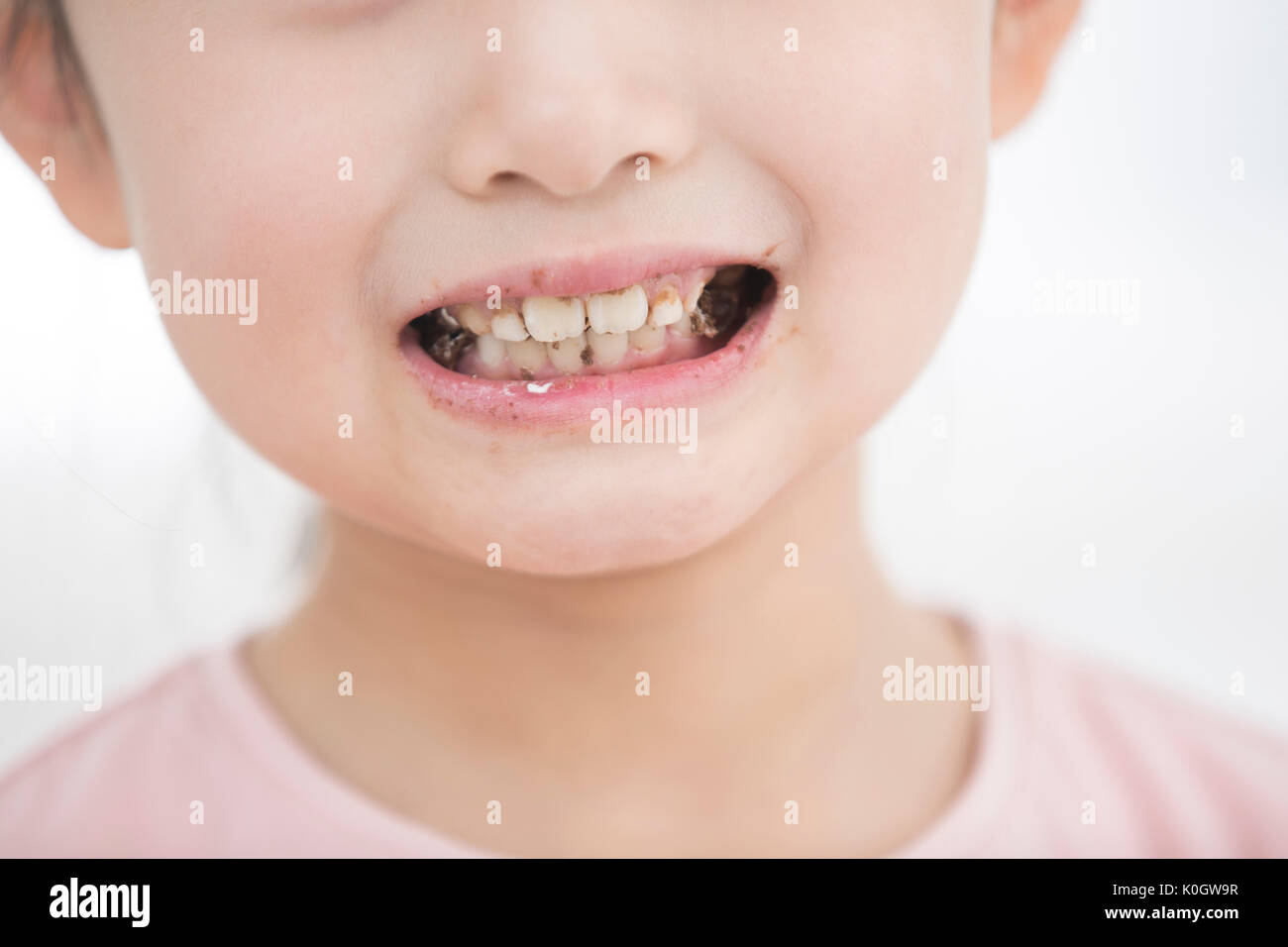 Closeup of girl showing her teeth Stock Photo - Alamy