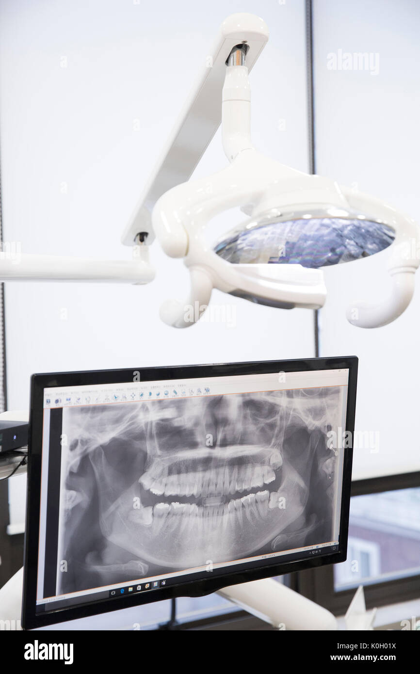 X-ray picture of teeth Stock Photo - Alamy