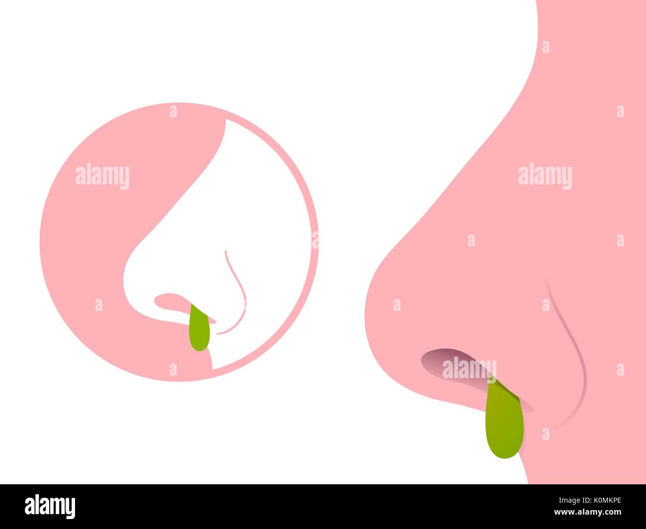 Worlds Biggest Nose Booger