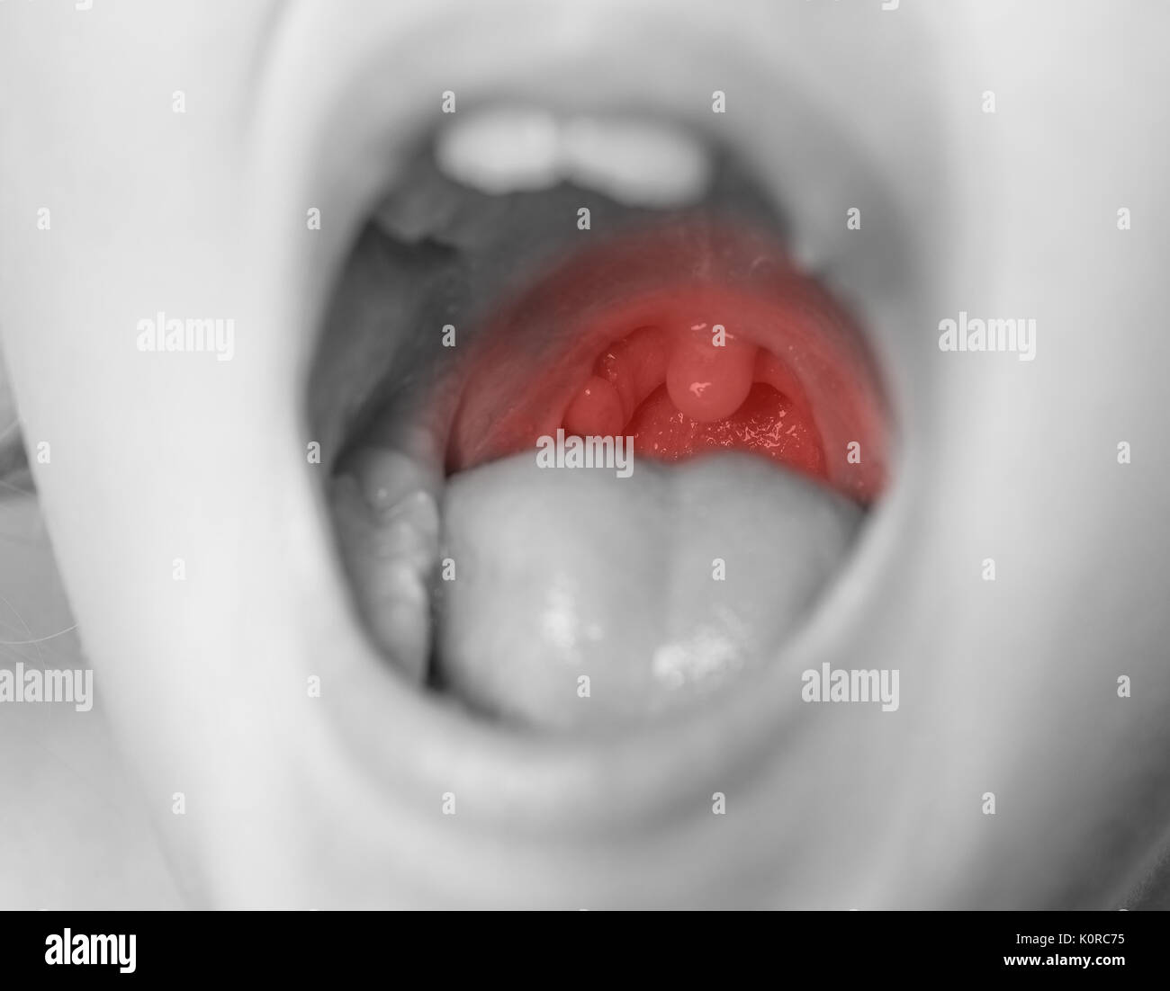 Healthy tonsils hi-res stock photography and images - Alamy