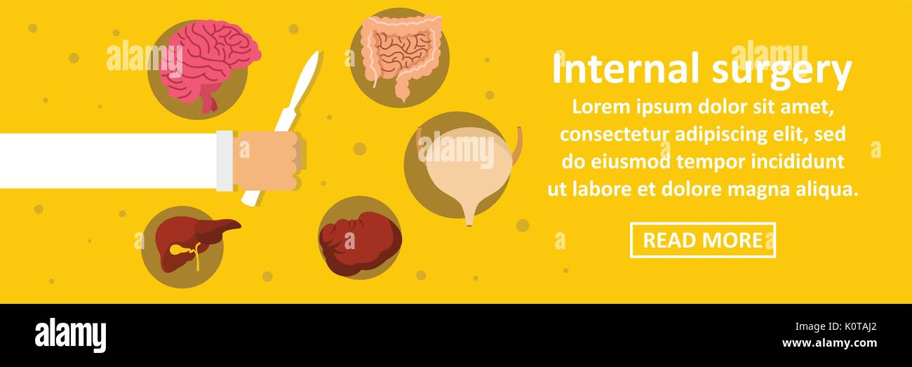 Internal surgery banner horizontal concept Stock Vector Image & Art - Alamy
