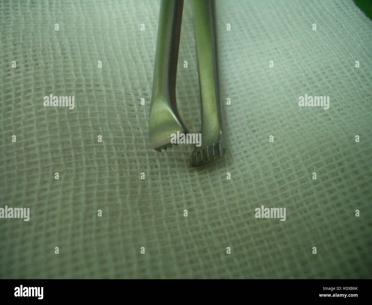Gynecological instruments hi-res stock photography and images - Alamy