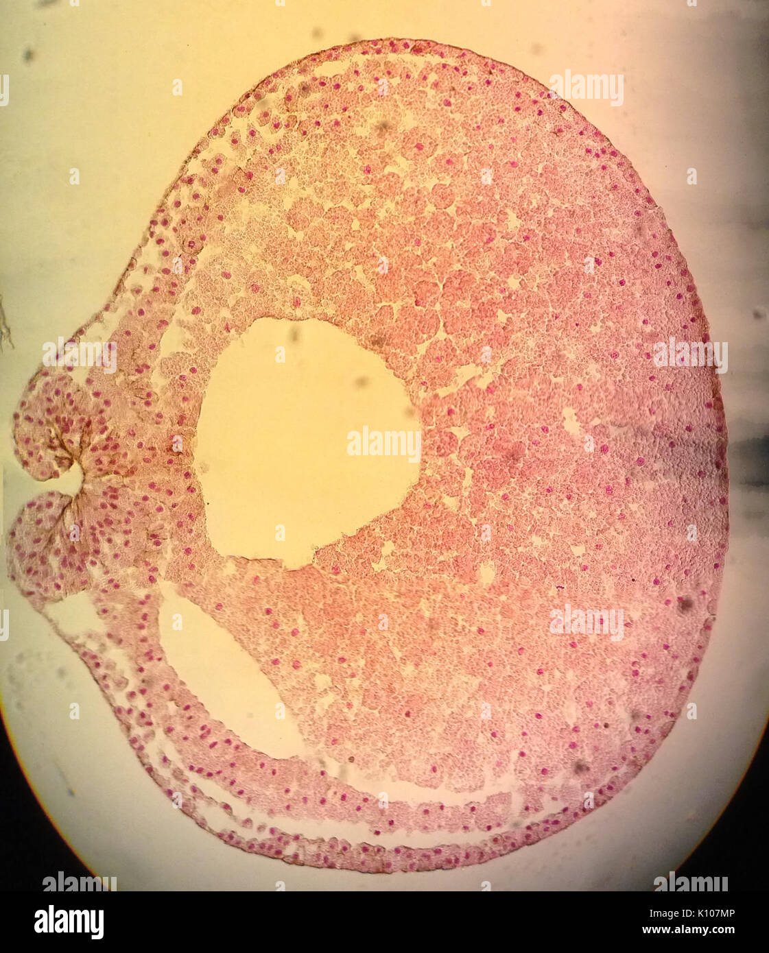 Neural fold hi-res stock photography and images - Alamy
