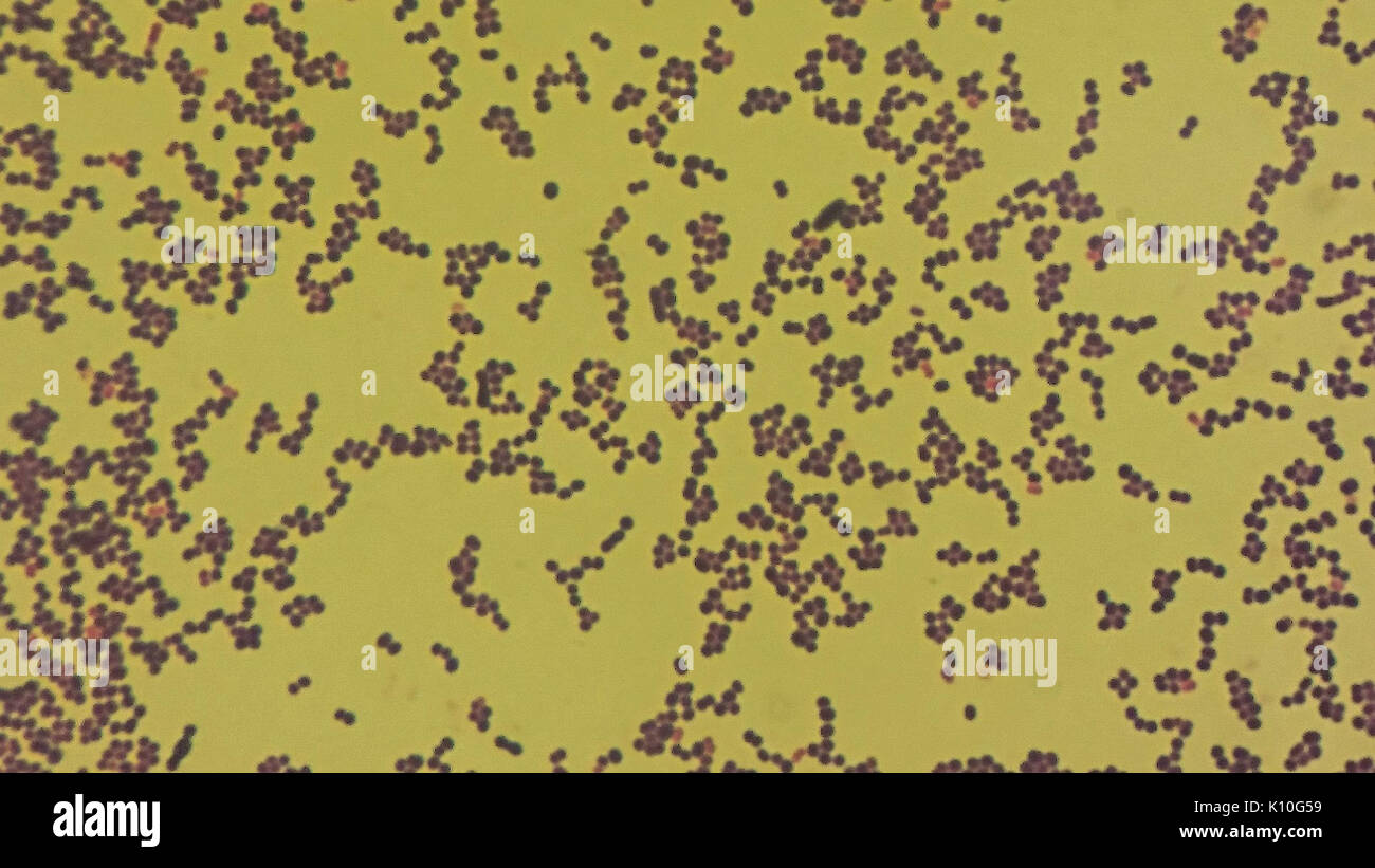 Aerococcus urinae microscopy Stock Photo - Alamy