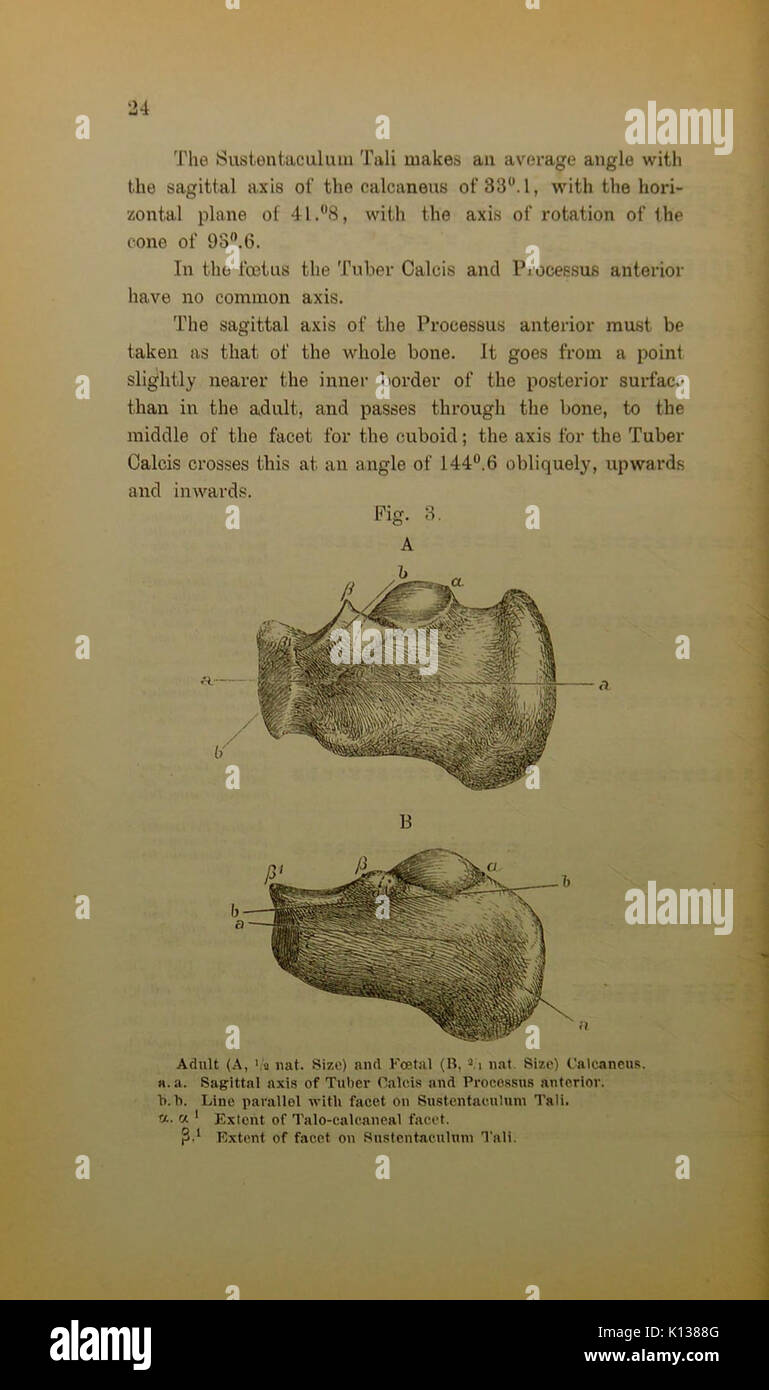 Bone growth comparison hi-res stock photography and images - Alamy