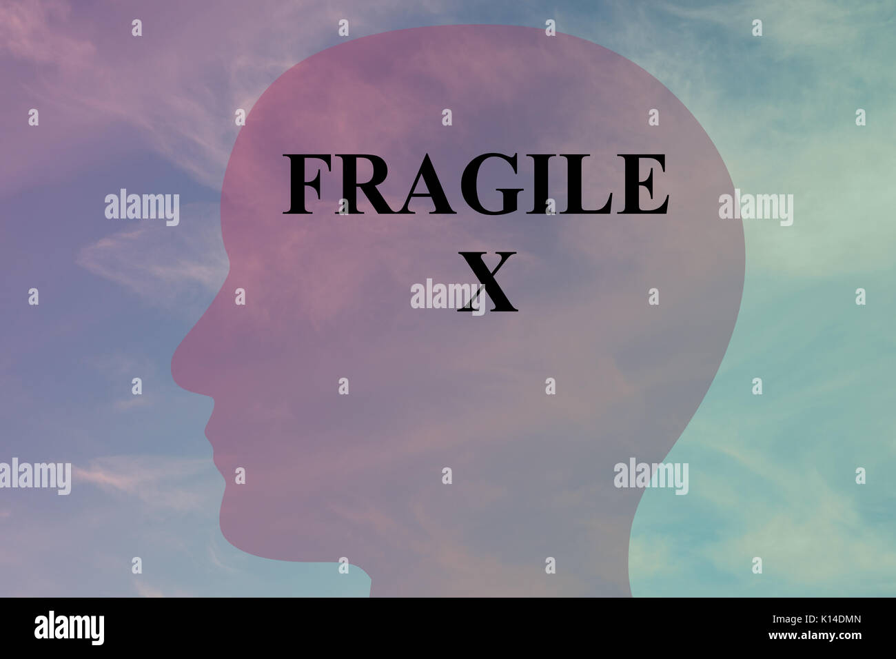 Fragile x syndrome hi-res stock photography and images - Alamy