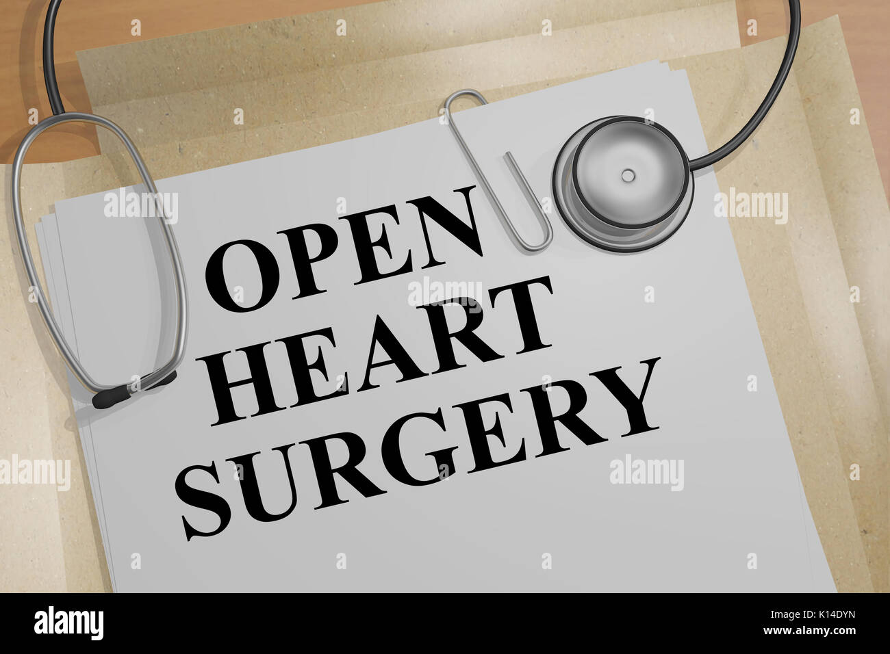 Open Heart Surgery High Resolution Stock Photography and Images - Alamy