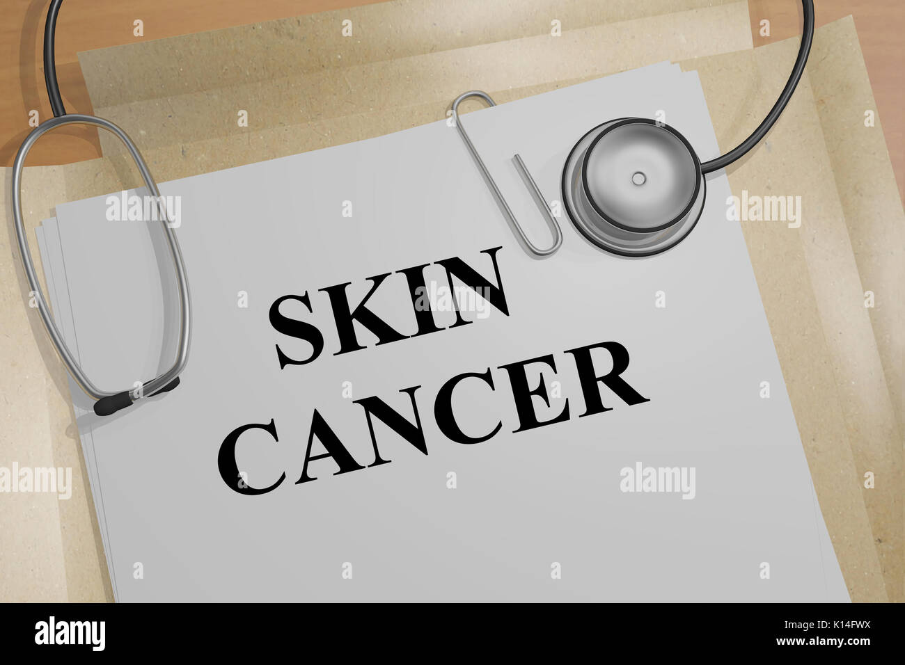 3D illustration of "SKIN CANCER" title on a medical document Stock ...