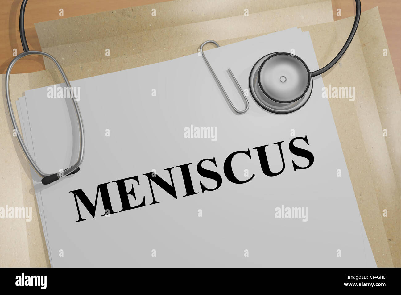 Tear of a meniscus hi-res stock photography and images - Alamy