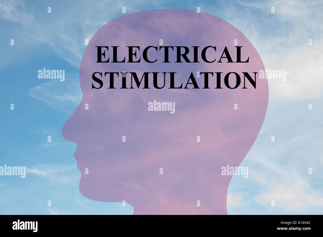 Render illustration of "ELECTRICAL STIMULATION" title on head ...