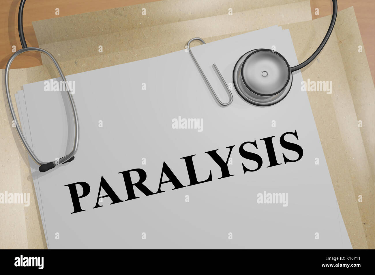 Traumatic vertebral fracture hi-res stock photography and images - Alamy