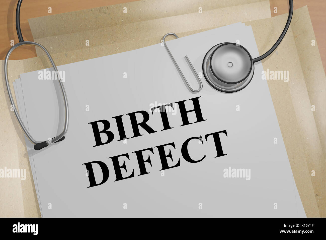Birth defect hi-res stock photography and images - Alamy