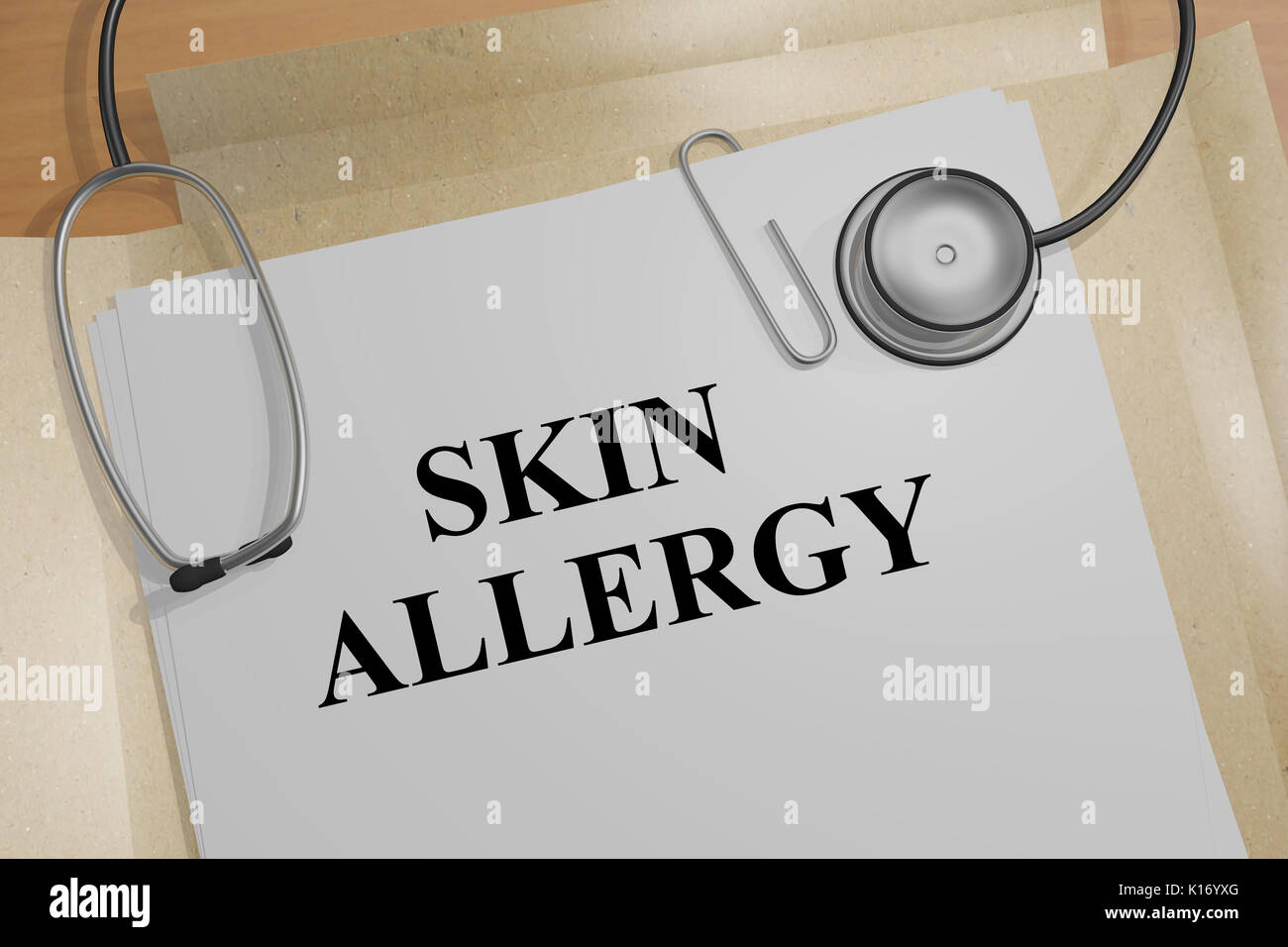 3D illustration of "SKIN ALLERGY" title on medical document Stock Photo ...