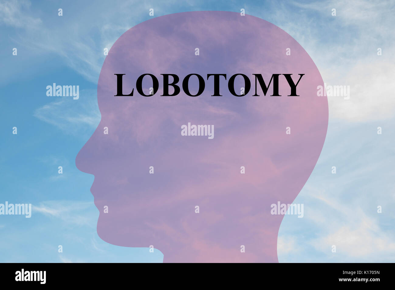 Render illustration of "LOBOTOMY" title on head silhouette, with cloudy ...