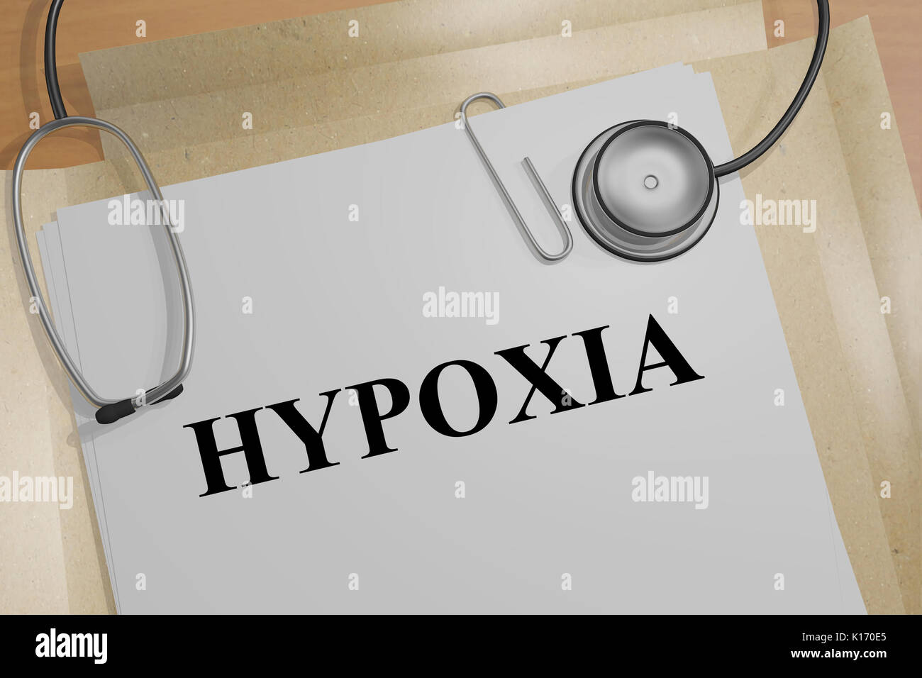 Hypoxia High Resolution Stock Photography and Images - Alamy