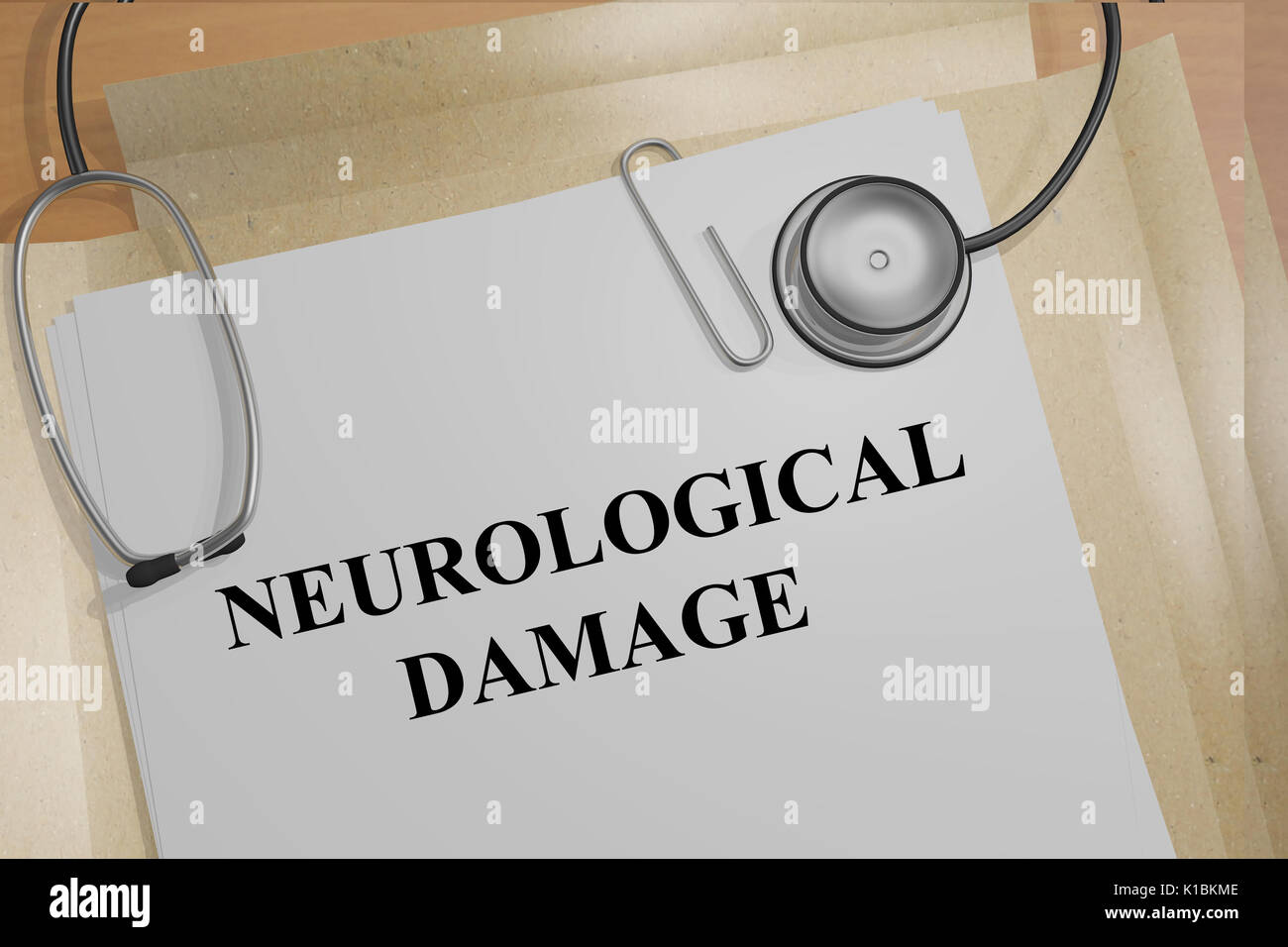 Neurological damage hi-res stock photography and images - Alamy